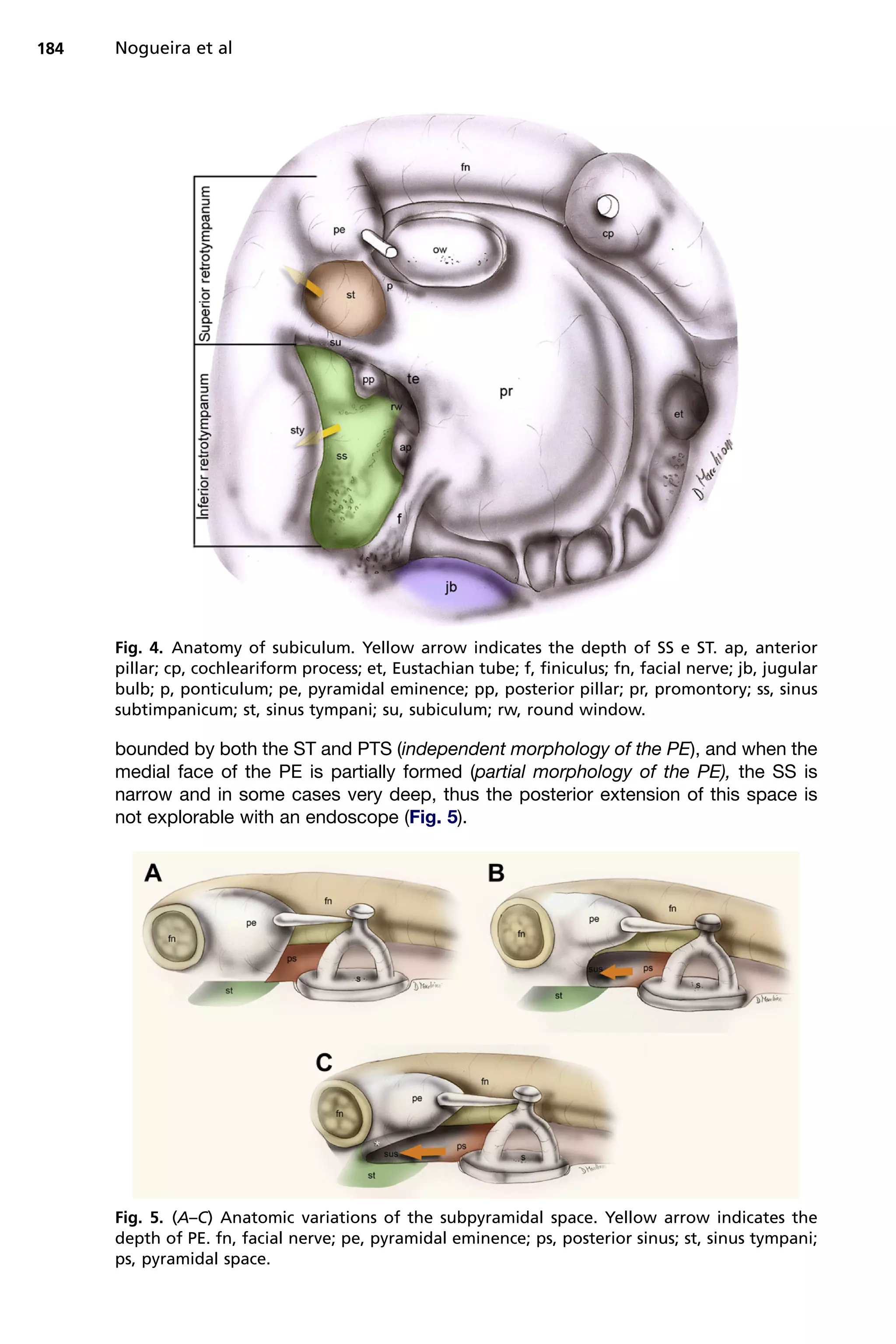 Endoscopic anatomy of Retrotympanum; Middle ear | PDF