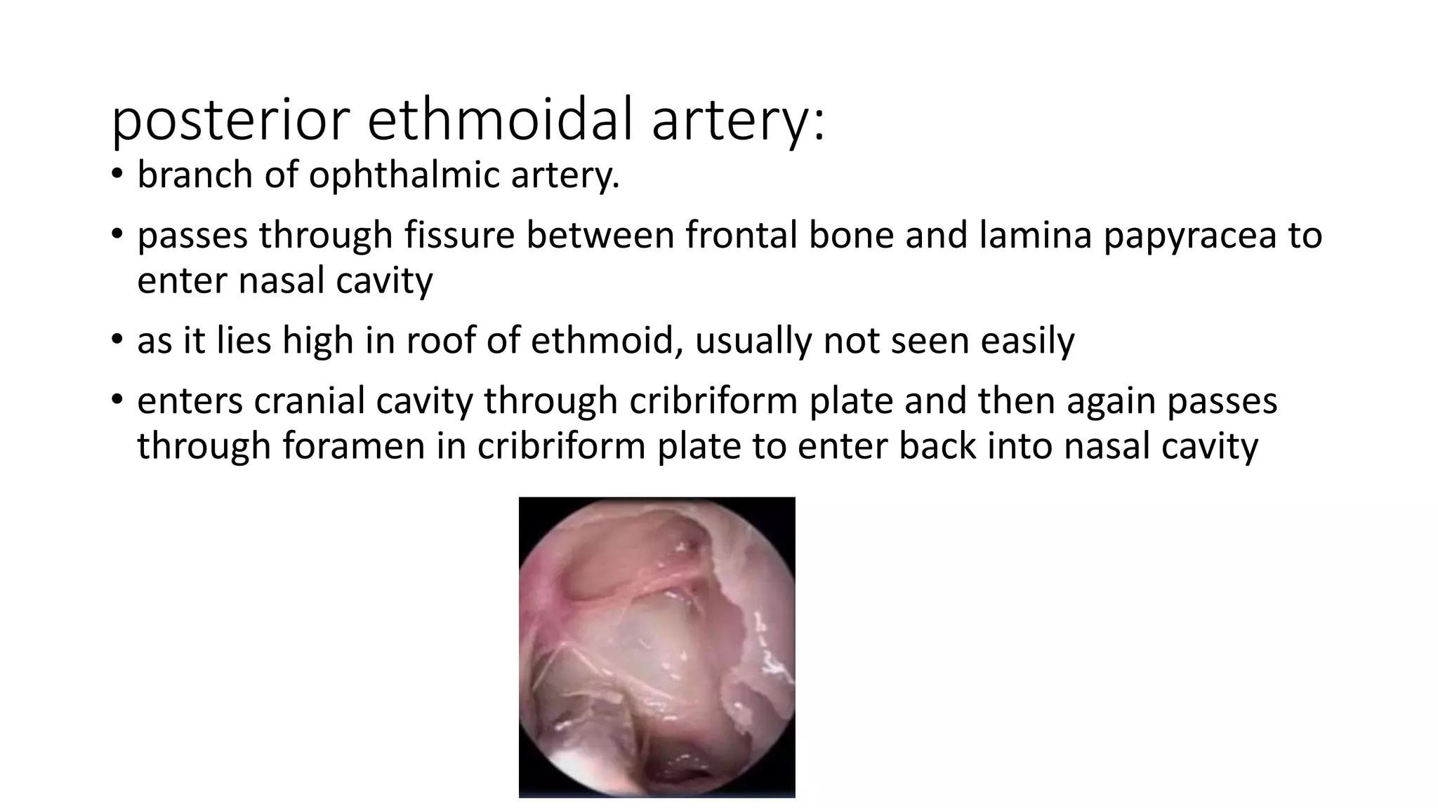 Endoscopic anatomy of ethmoid bone | PDF | Ear, Nose and Throat ...