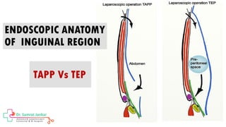endoscopic anatomy of inguinal region.pptx