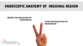 endoscopic anatomy of inguinal region.pptx