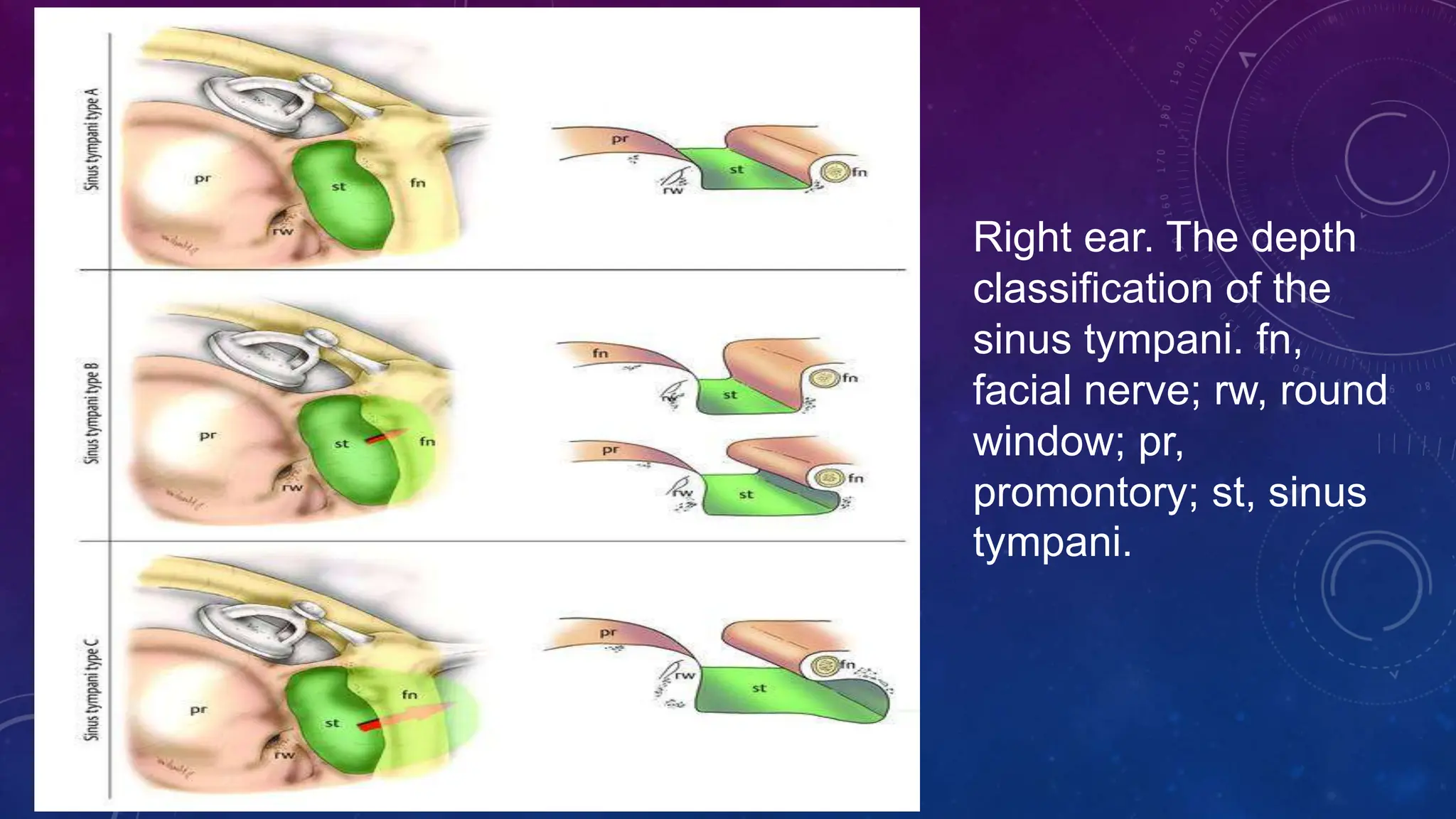 Endoscopic anatomy of middle ear.jshpptx | PPTX