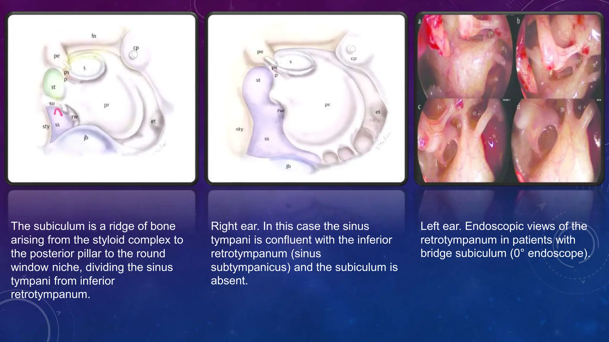 Endoscopic anatomy of middle ear.jshpptx | PPTX