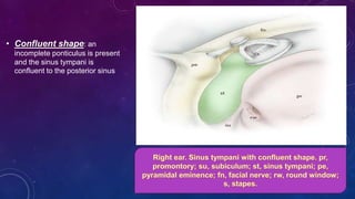 Endoscopic anatomy of middle ear.jshpptx | PPTX