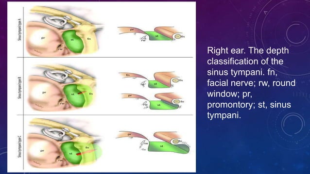 Endoscopic anatomy of middle ear.jshpptx | PPTX