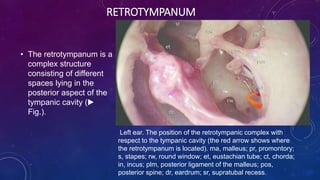 Endoscopic anatomy of middle ear.jshpptx | PPTX