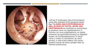 ENDOSCOPIC ANATOMY OF MIDDLE EAR CLEFT AND MUCOSAL FOLDS.pptx