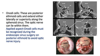 endoscopic anatomy of nasal cavity & paranasal sinuses.pptx