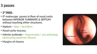 endoscopic anatomy of nasal cavity & paranasal sinuses.pptx