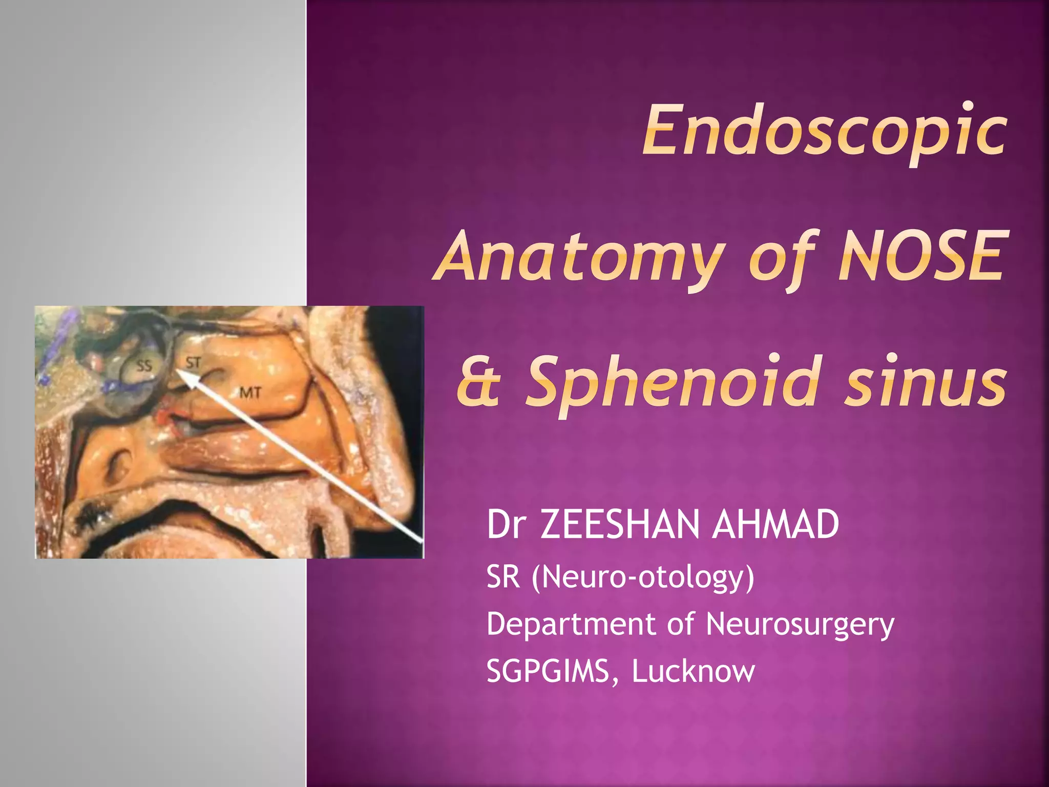 Endoscopic anatomy of nose and sphenoid sinus | PPTX