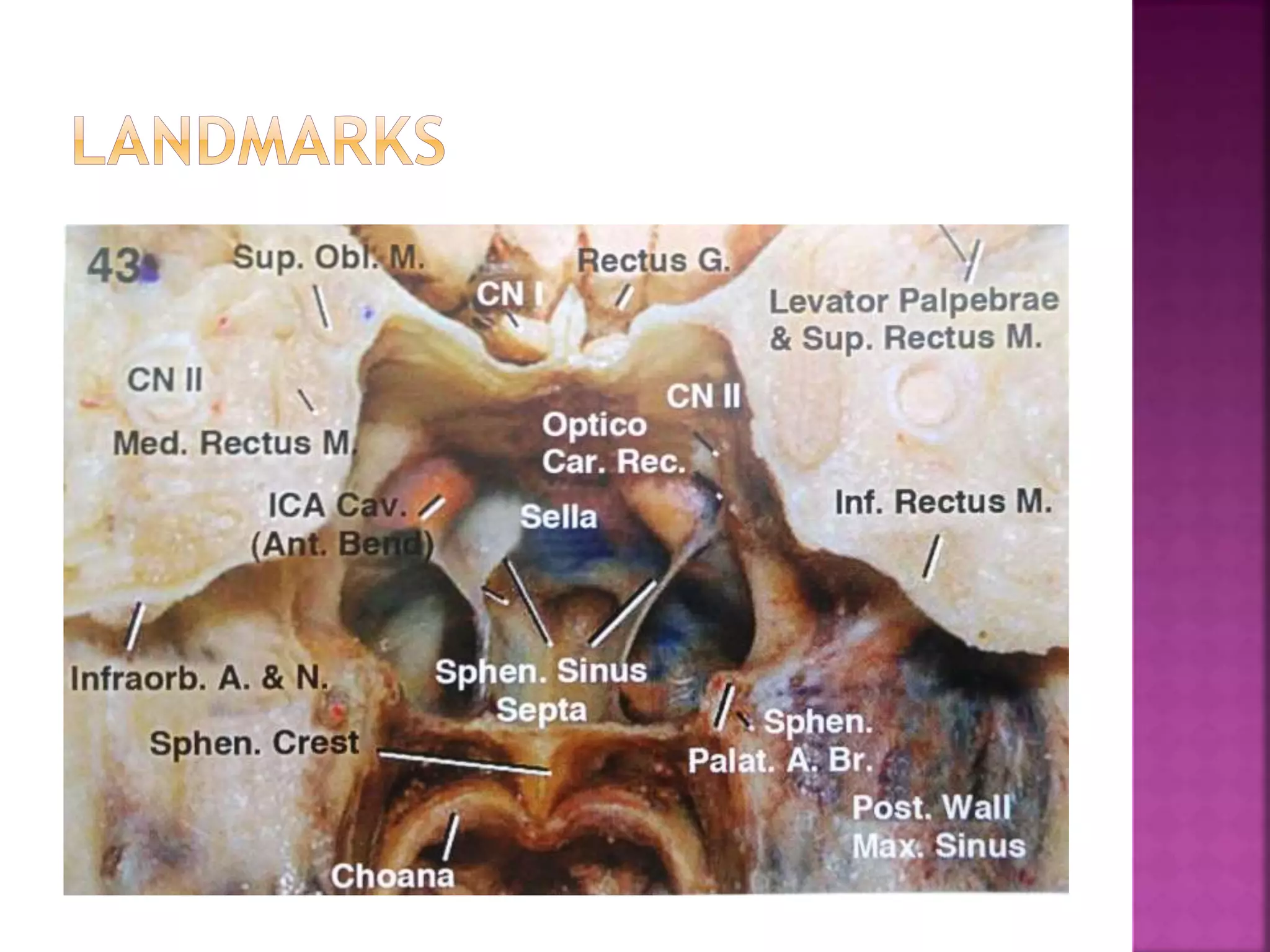 Endoscopic anatomy of nose and sphenoid sinus | PPTX