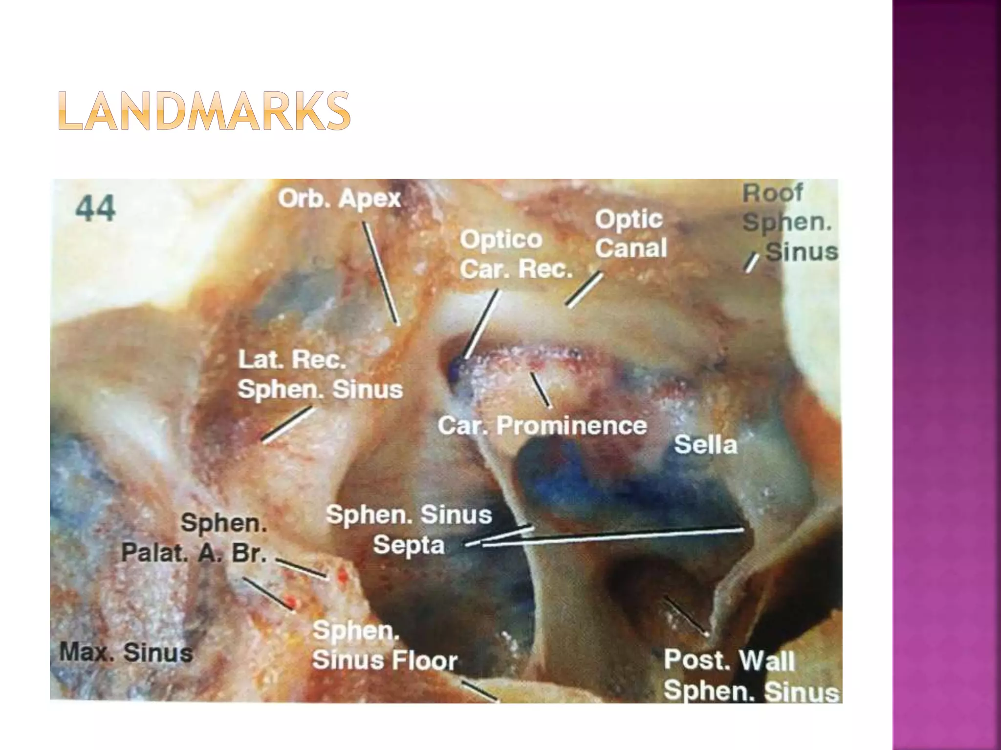 Endoscopic anatomy of nose and sphenoid sinus | PPTX