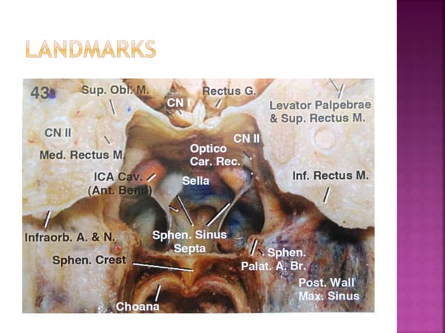 Endoscopic anatomy of nose and sphenoid sinus | PPTX | Ear, Nose and ...