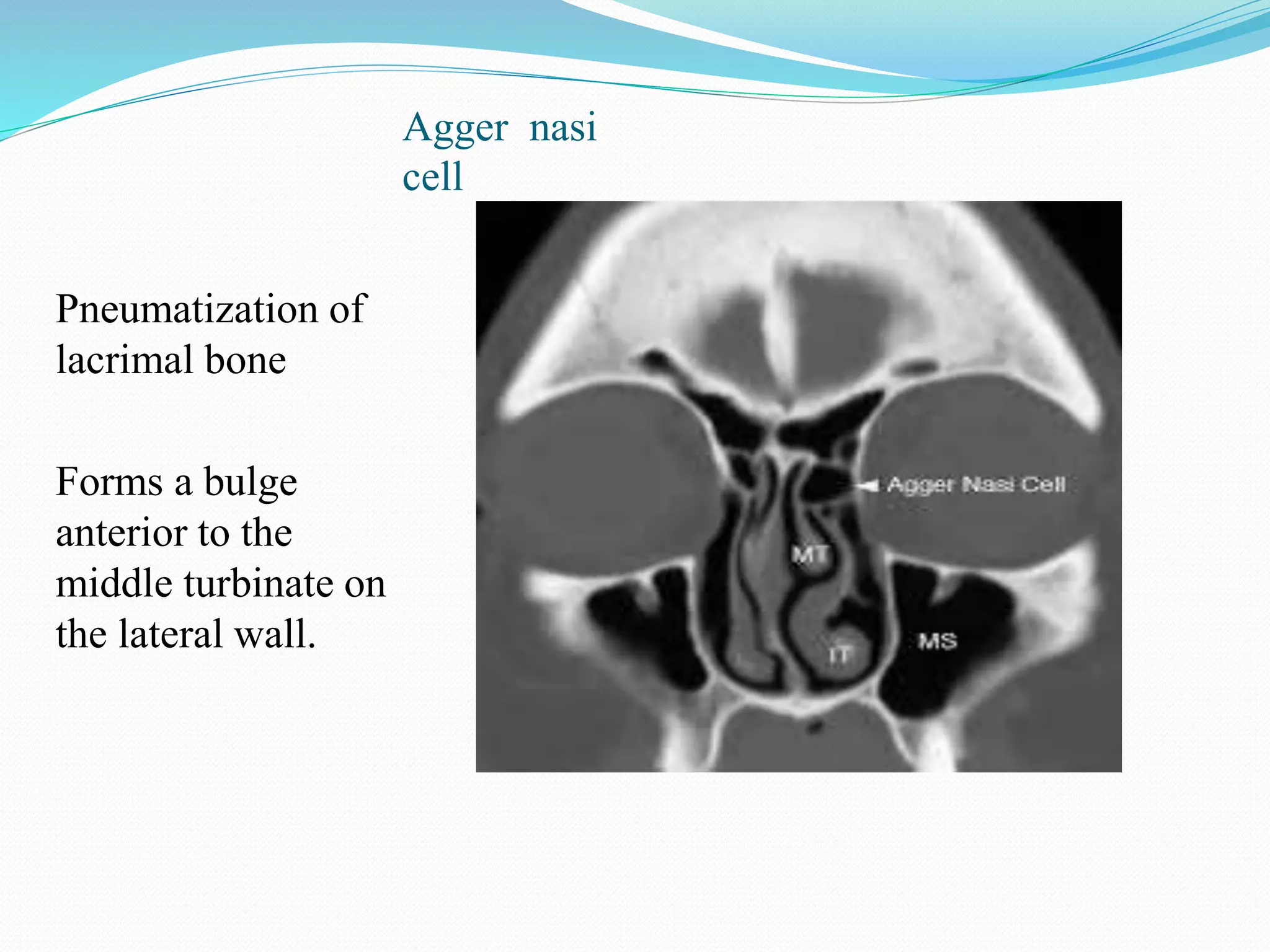 Endoscopic anatomy of nose ,paranasal sinus and anterior skull base | PPTX