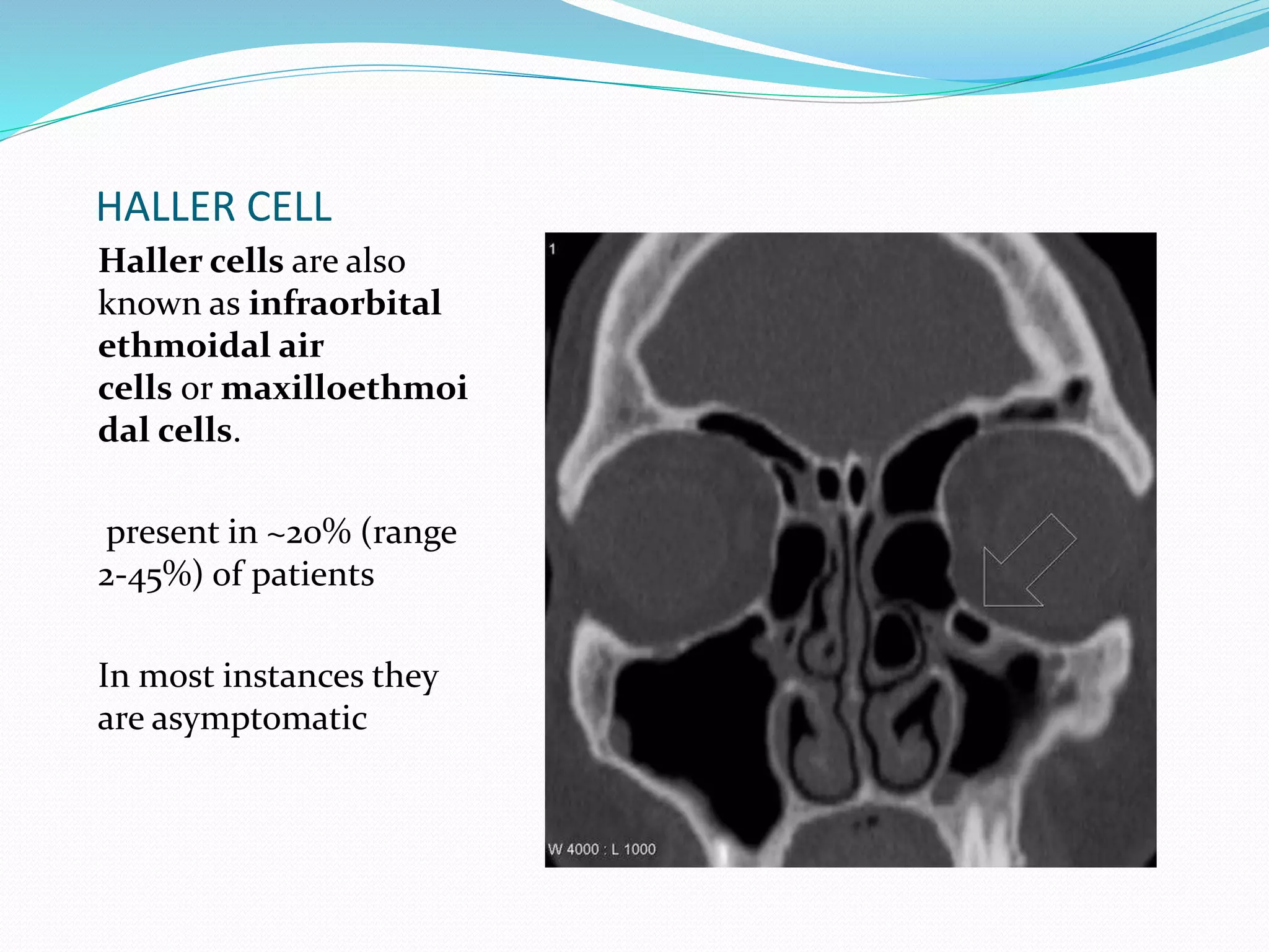 Endoscopic anatomy of nose ,paranasal sinus and anterior skull base | PPTX