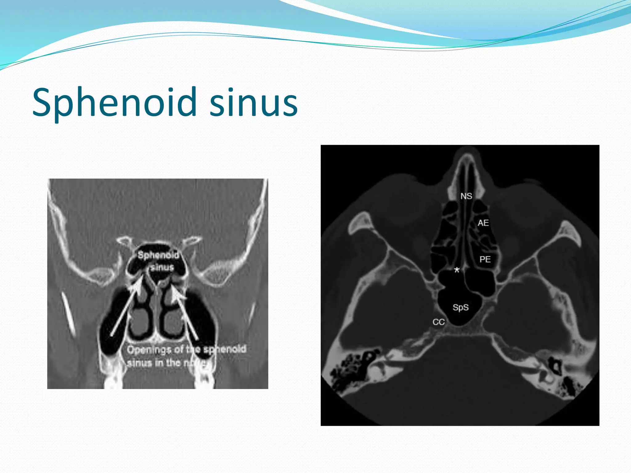 Endoscopic anatomy of nose ,paranasal sinus and anterior skull base | PPTX