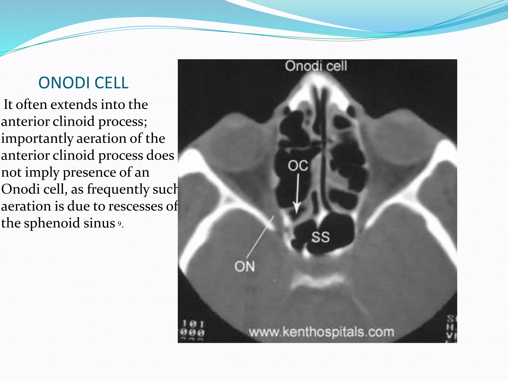 Endoscopic anatomy of nose ,paranasal sinus and anterior skull base | PPTX