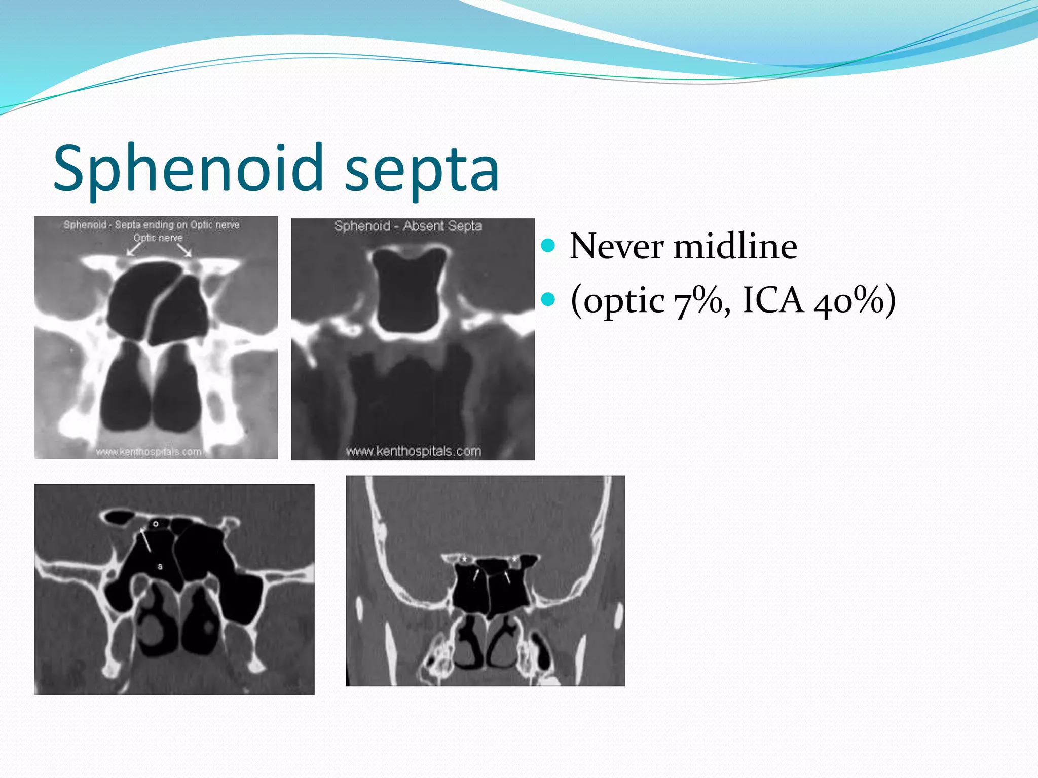 Endoscopic anatomy of nose ,paranasal sinus and anterior skull base | PPTX