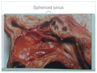 Endoscopic anatomy of nose and PNS | PPTX