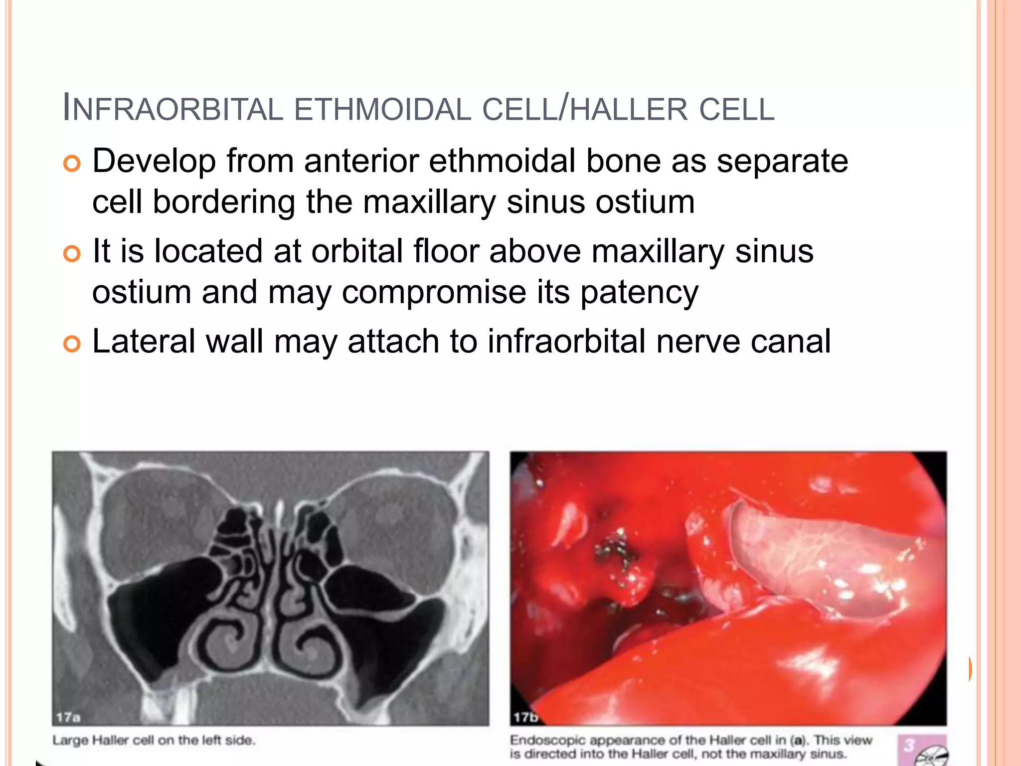 Endoscopic anatomy of Nose, PNS and anterior skull base | PPTX