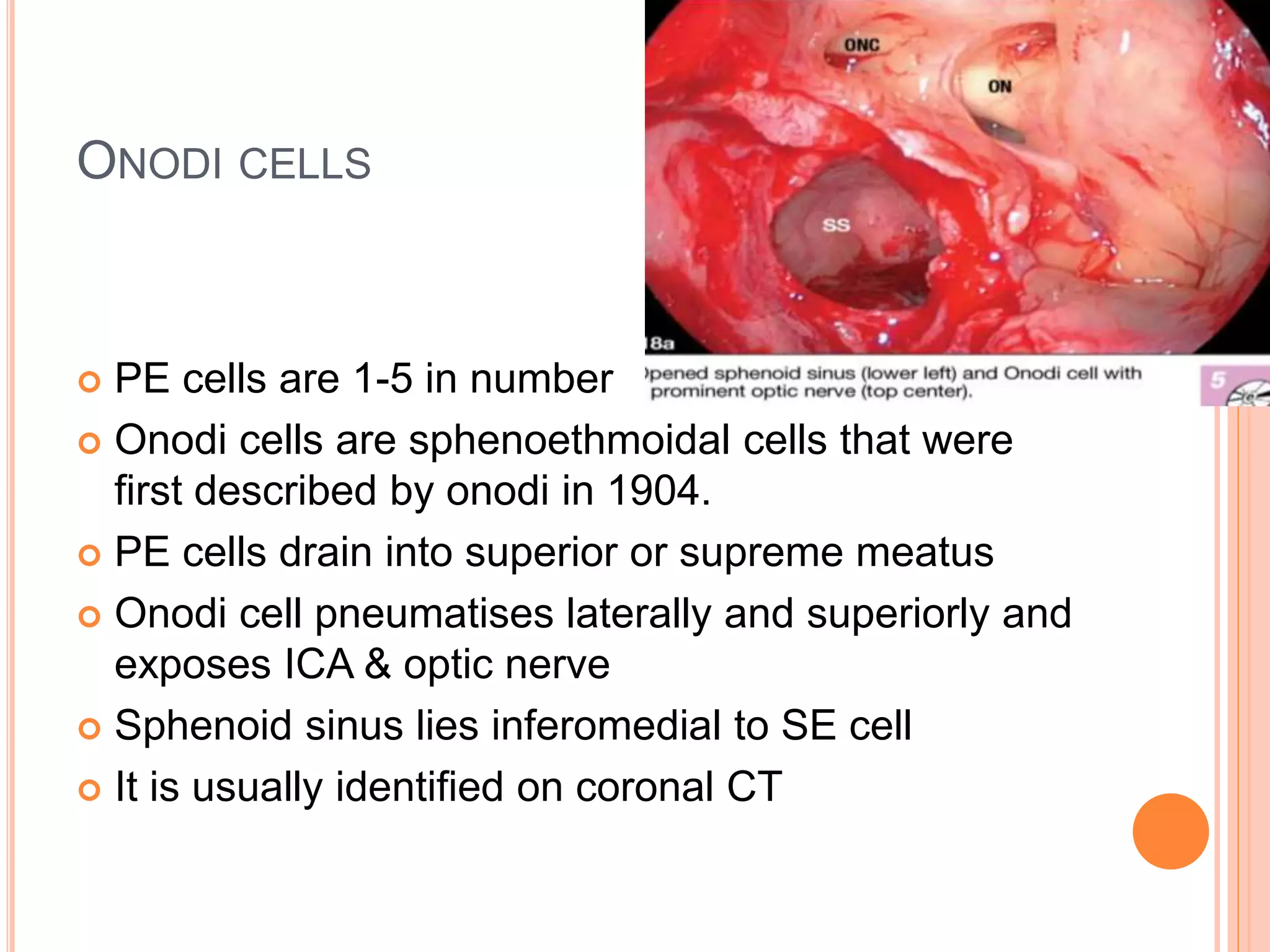 Endoscopic anatomy of Nose, PNS and anterior skull base | PPTX