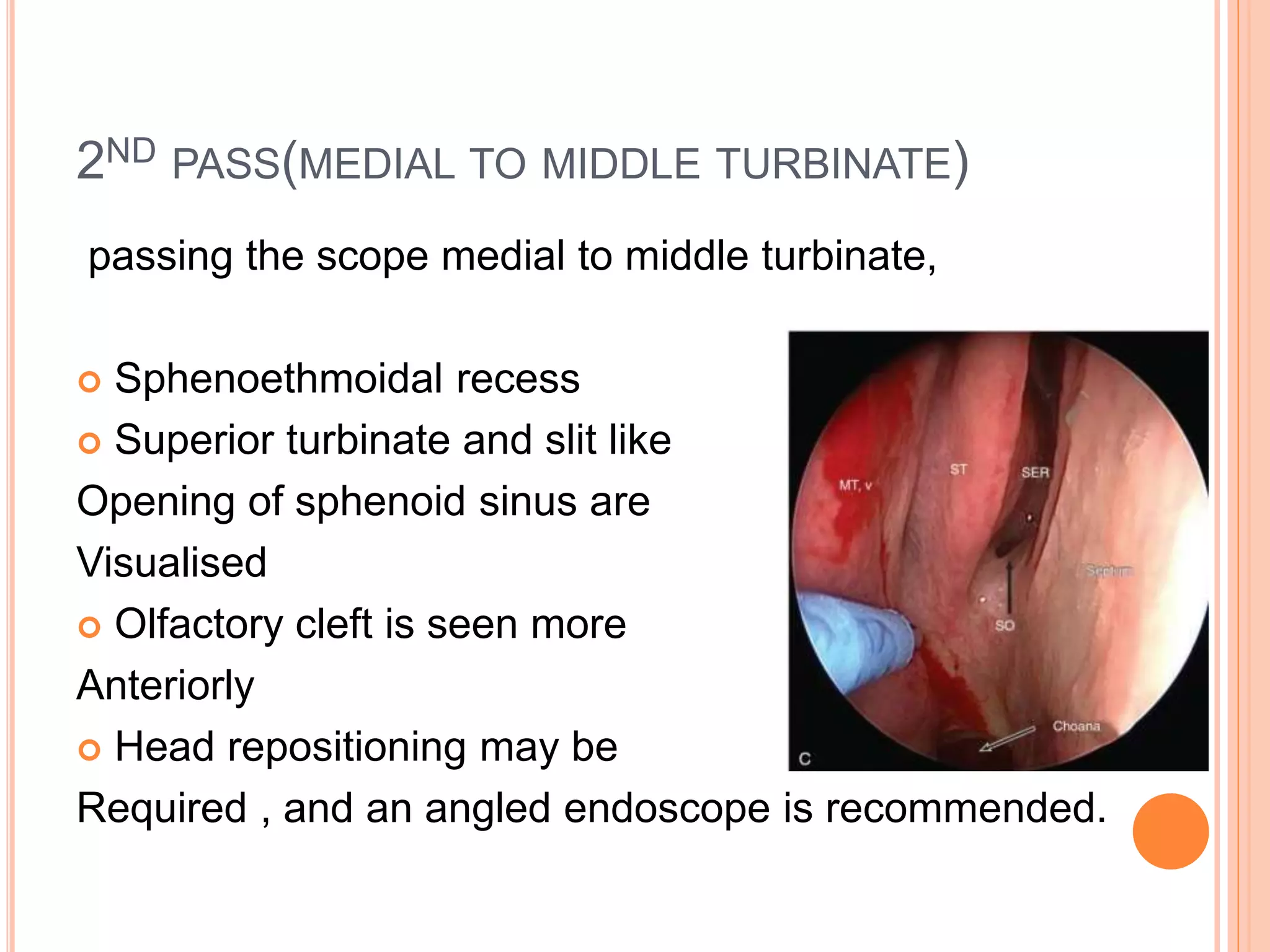 Endoscopic anatomy of Nose, PNS and anterior skull base | PPTX