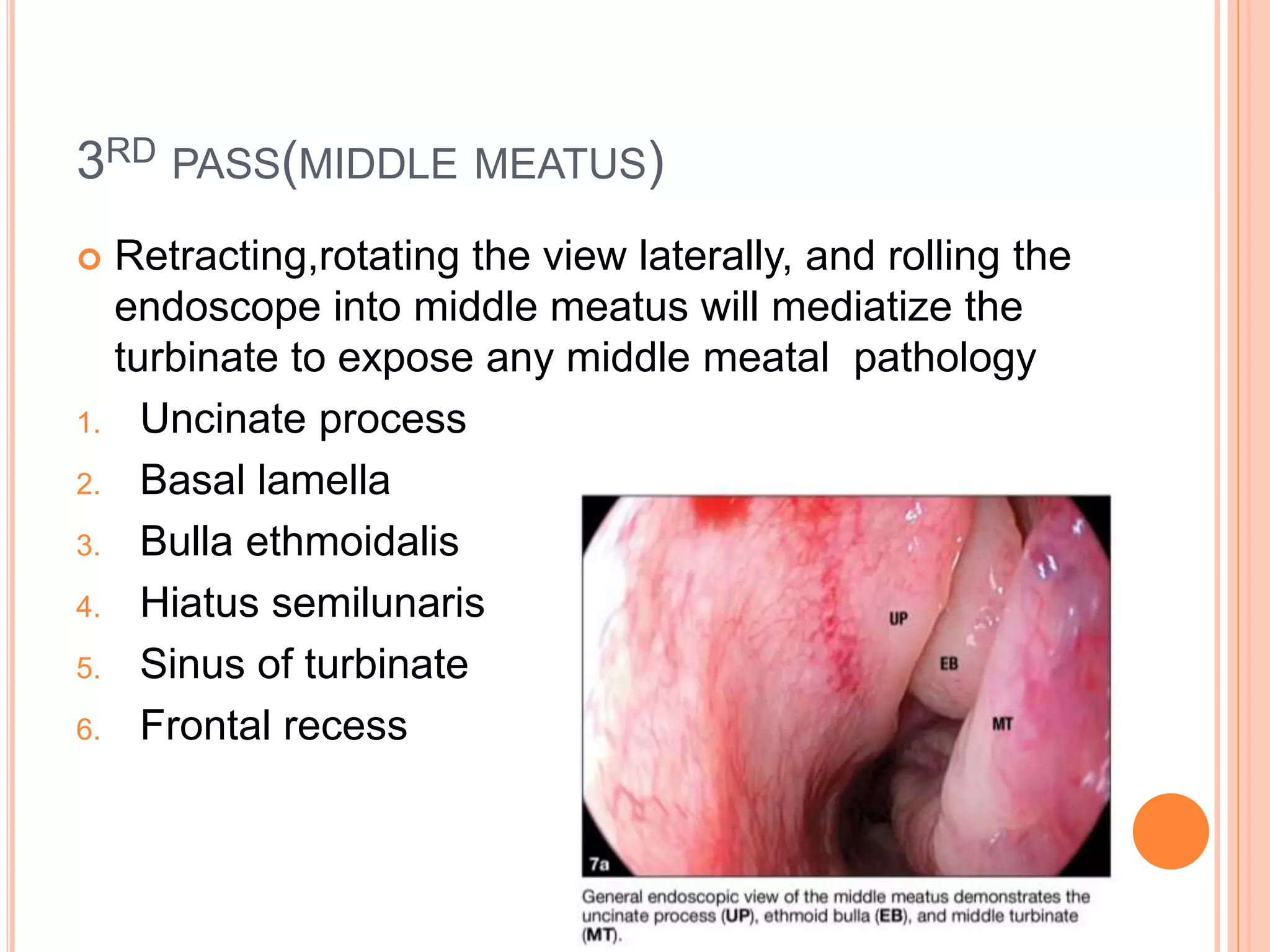 Endoscopic anatomy of Nose, PNS and anterior skull base | PPTX
