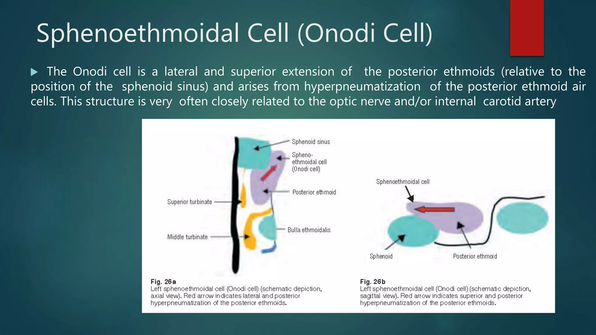 Endoscopic anatomy of paranasal sinuses | PPTX