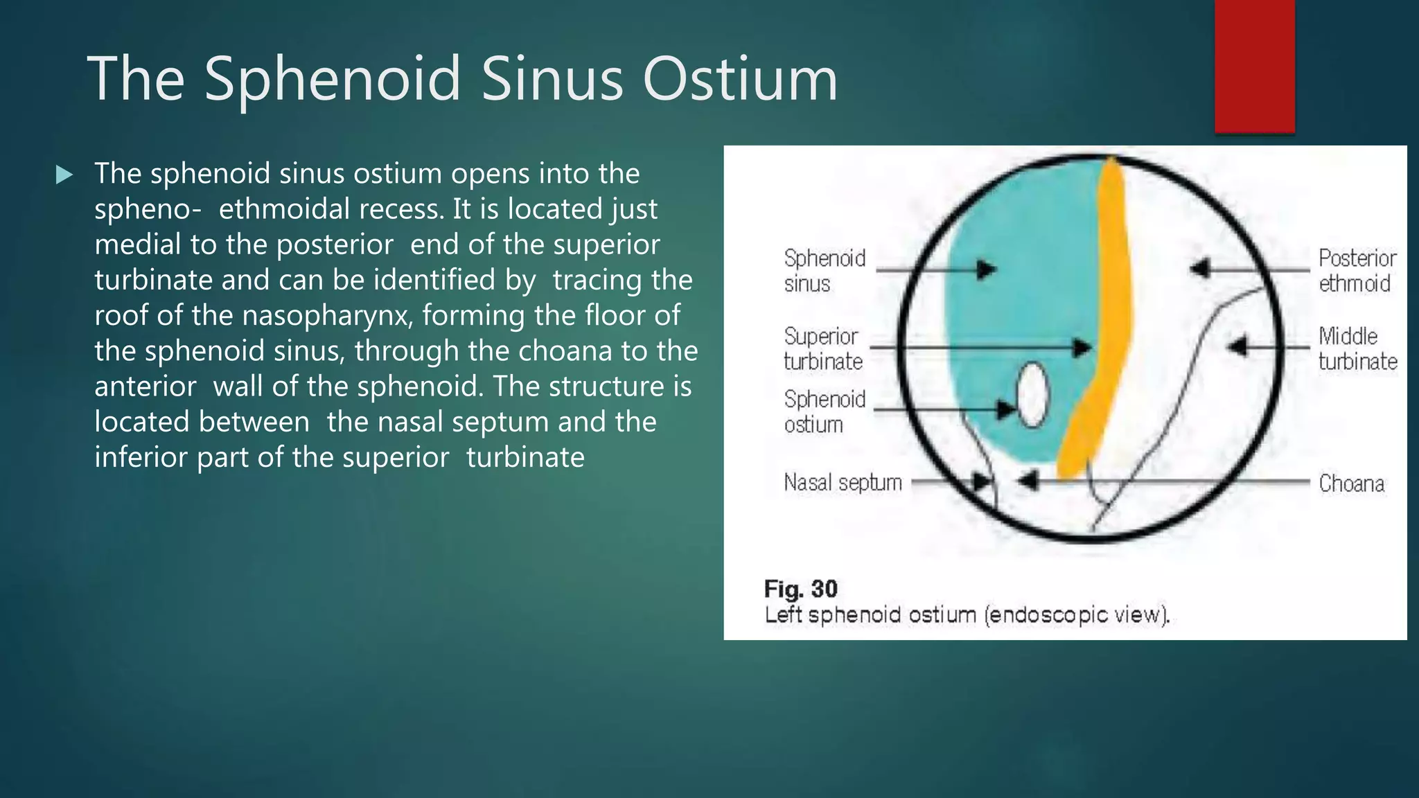 Endoscopic anatomy of paranasal sinuses | PPTX