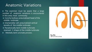 Endoscopic anatomy of paranasal sinuses | PPTX