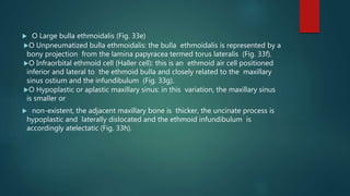 Endoscopic anatomy of paranasal sinuses | PPTX