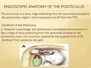 endoscopic anatomy of retrotympanum.pptx