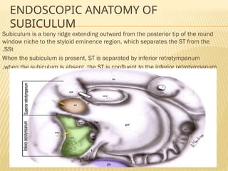 endoscopic anatomy of retrotympanum.pptx