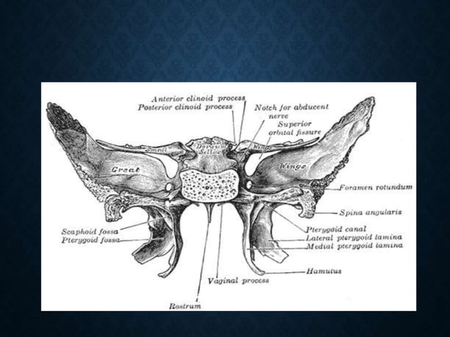 Endoscopic anatomy of lateral wall of sphenoid sinus | PPT