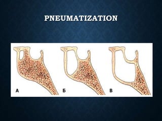 Endoscopic anatomy of lateral wall of sphenoid sinus | PPT