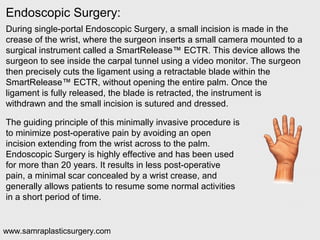 Endoscopic Carpal Tunnel Release NJ | PPT