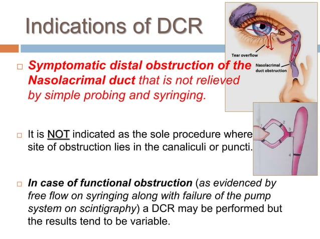 Endoscopic (DCR) Dacryocystorhinostomy