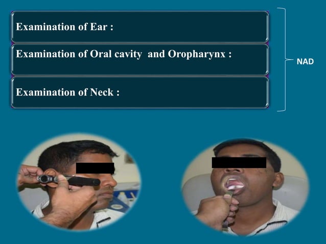 Endoscopic DCR Operation | PPTX | Ear, Nose and Throat Conditions ...