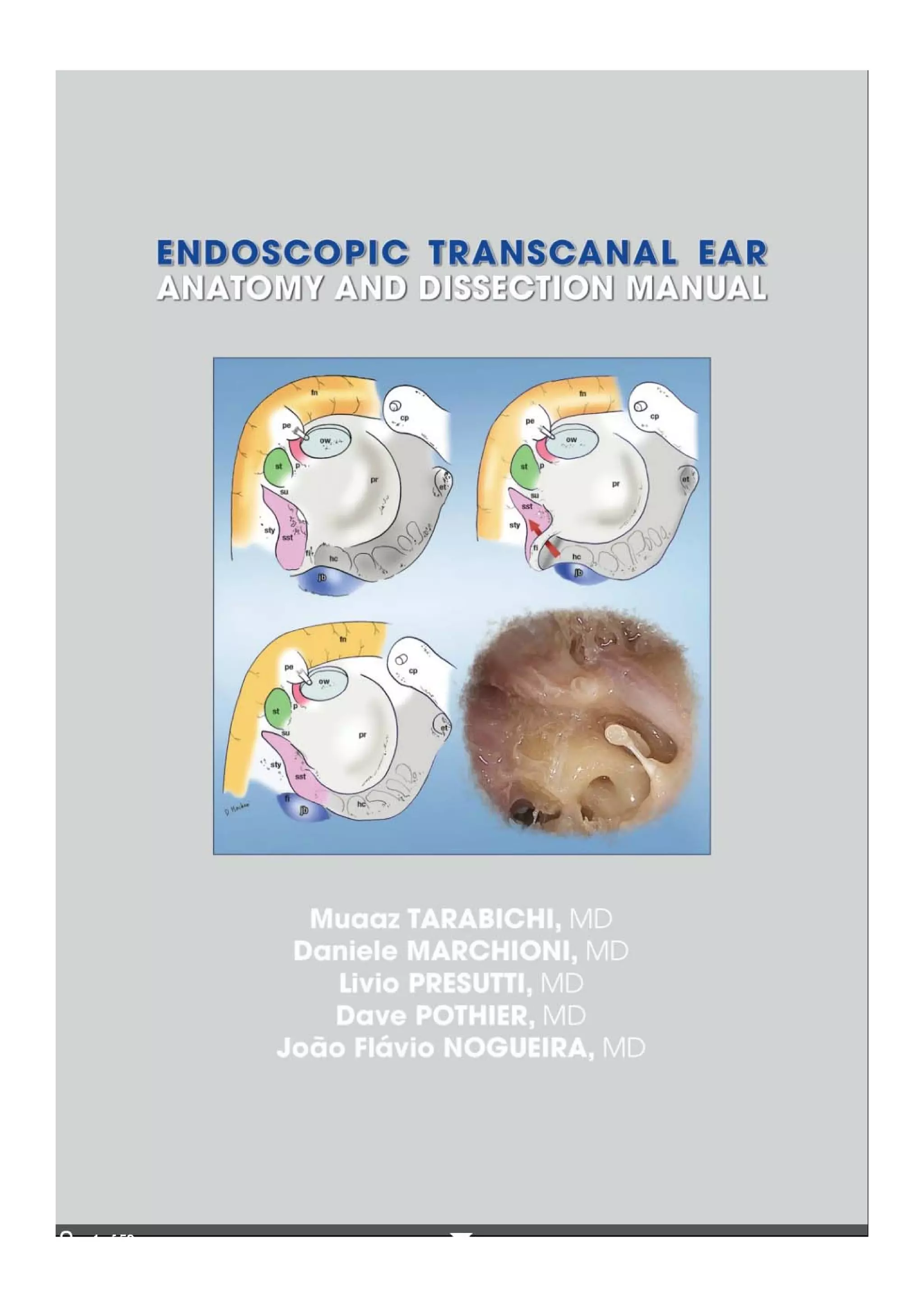 Endoscopic ear anatomy & Dissection | PDF | Ear, Nose and Throat ...