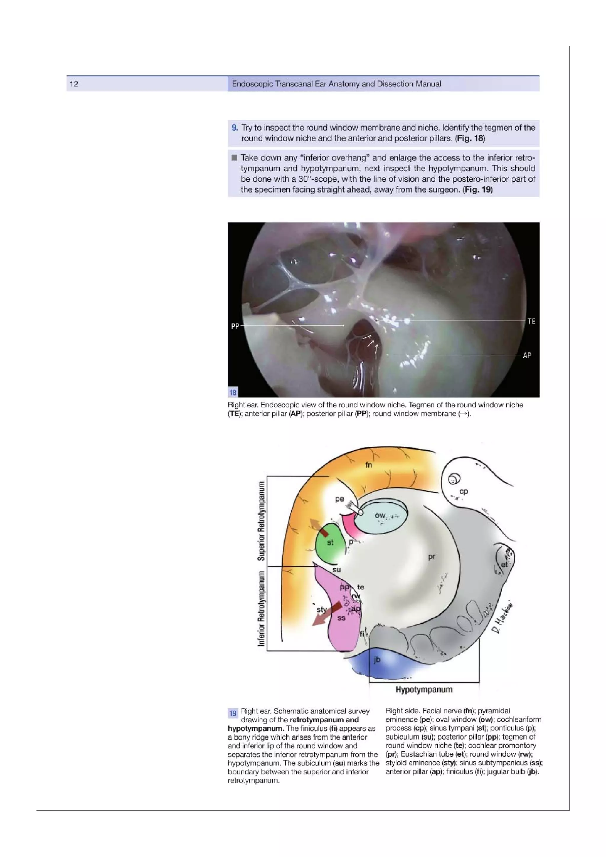 Endoscopic ear anatomy & Dissection | PDF | Ear, Nose and Throat ...
