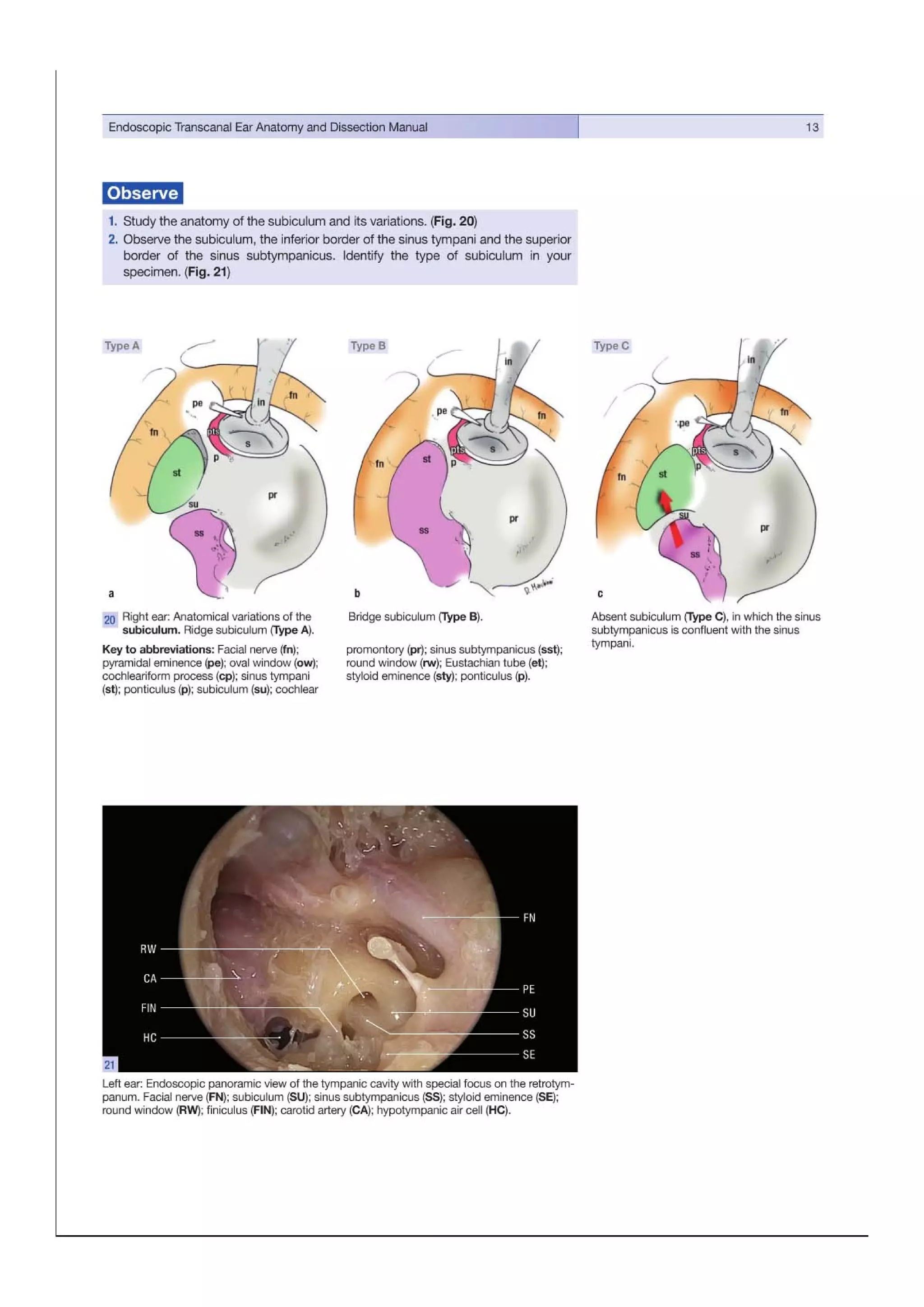 Endoscopic ear anatomy & Dissection | PDF | Ear, Nose and Throat ...