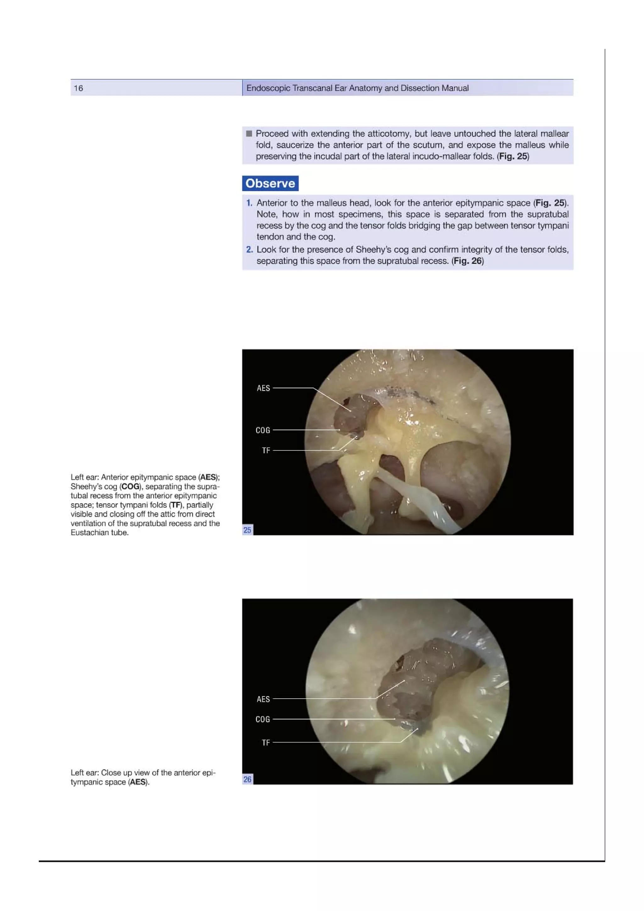 Endoscopic ear anatomy & Dissection | PDF | Ear, Nose and Throat ...