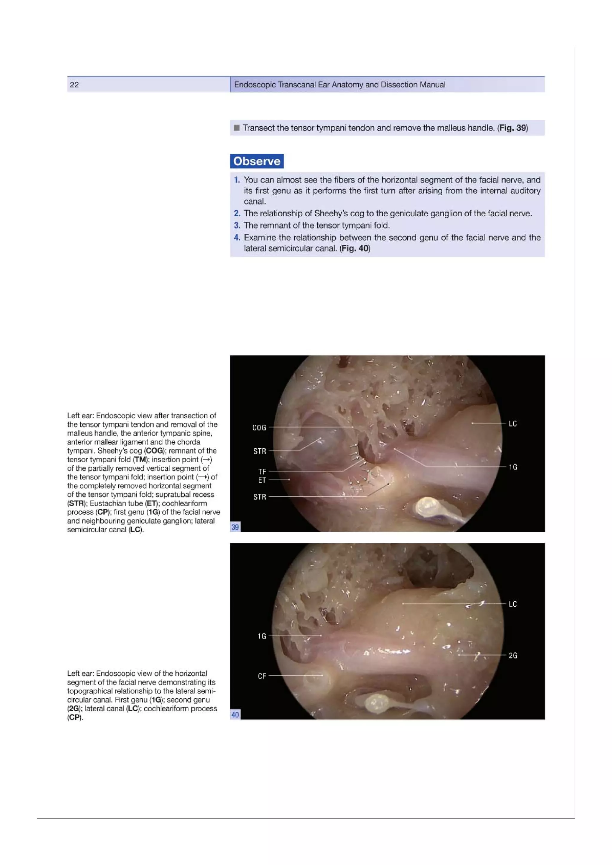 Endoscopic ear anatomy & Dissection | PDF