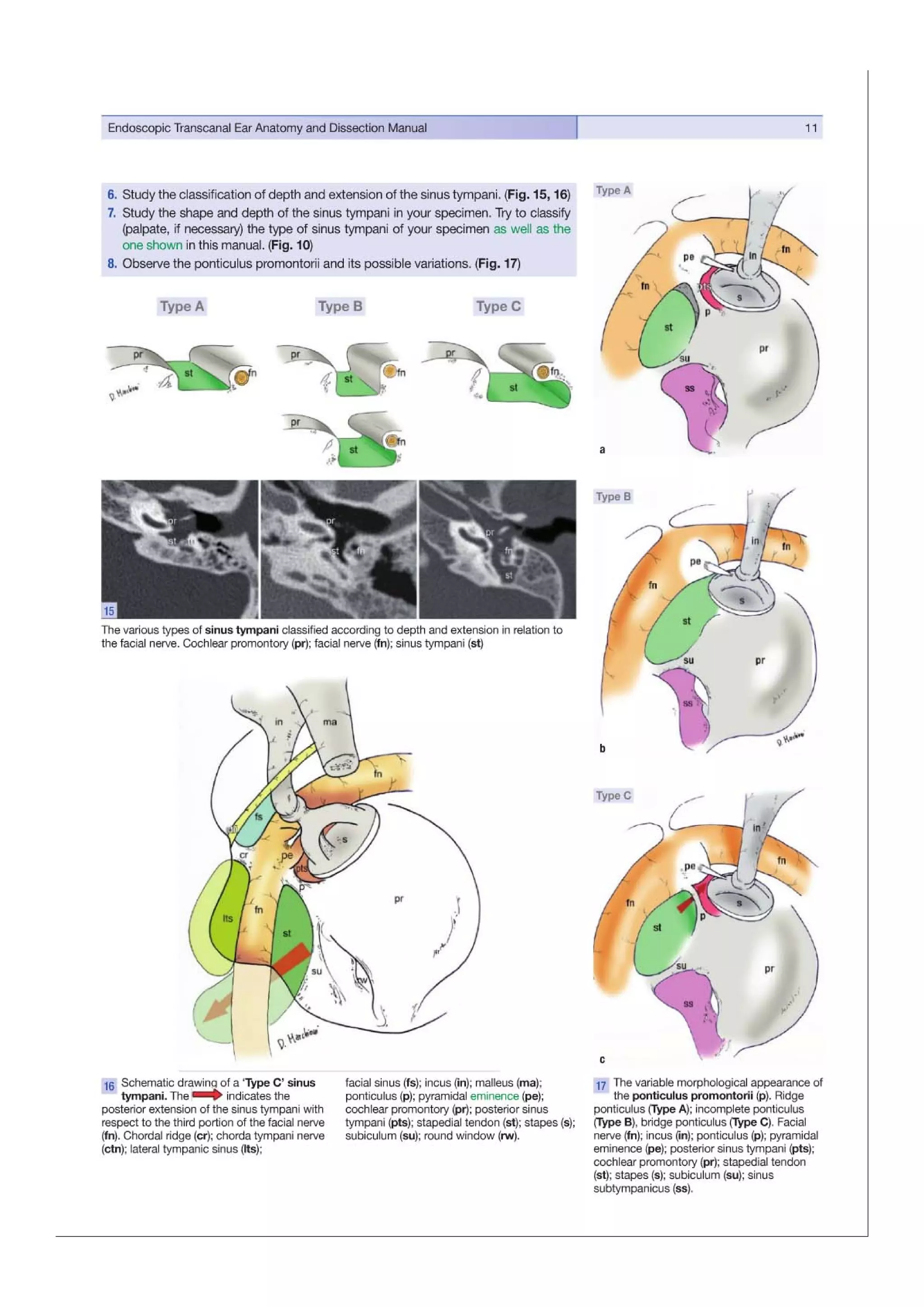 Endoscopic ear anatomy & Dissection | PDF | Ear, Nose and Throat ...