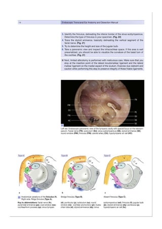 Endoscopic ear anatomy & Dissection | PDF | Ear, Nose and Throat ...