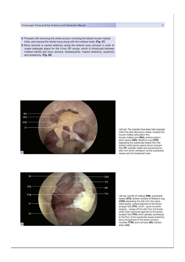 Endoscopic ear anatomy & Dissection | PDF