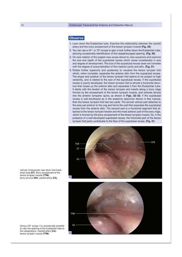 Endoscopic ear anatomy & Dissection | PDF