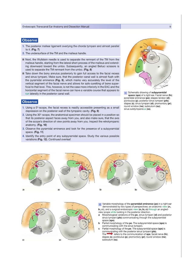 Endoscopic ear anatomy & Dissection | PDF