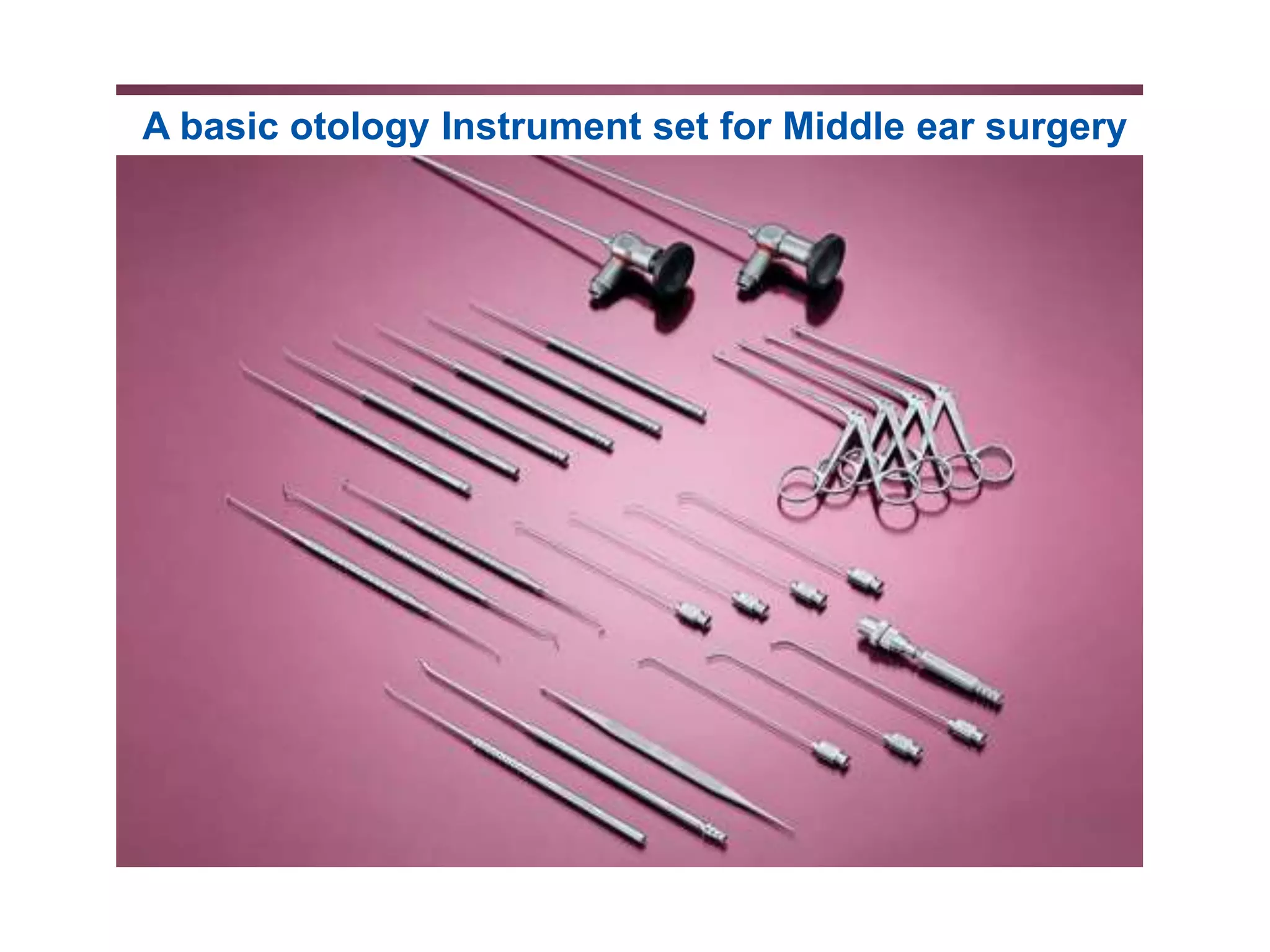 Endoscopic ear surgery | PPTX