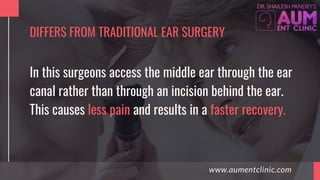Endoscopic Ear Surgery | PDF