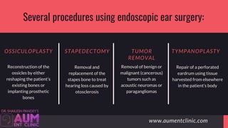 Endoscopic Ear Surgery | PDF
